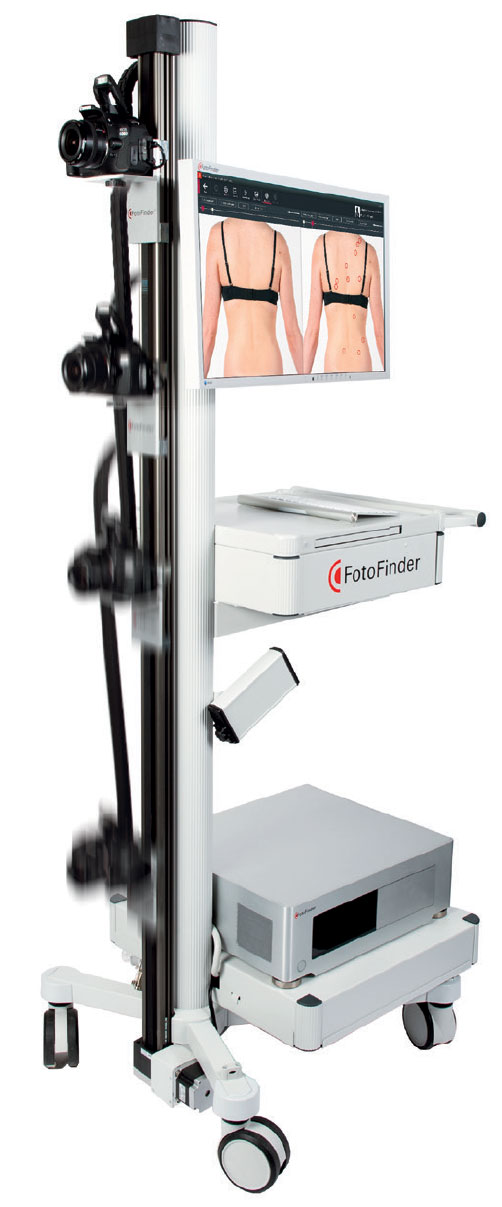 Dermatoscopia digitală Fotofinder - New Derm Clinic